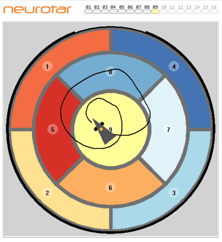 Mouse locomotion tracking - Neurotar